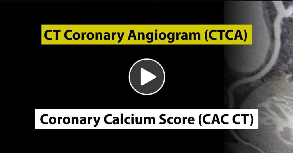 Coronary Calcium Score: Nuts and Bolts